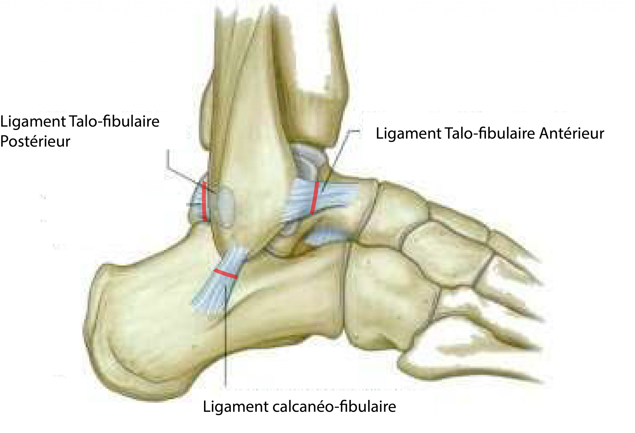 L'entorse de la Cheville : comprendre, traiter et prévenir - Clinique ...